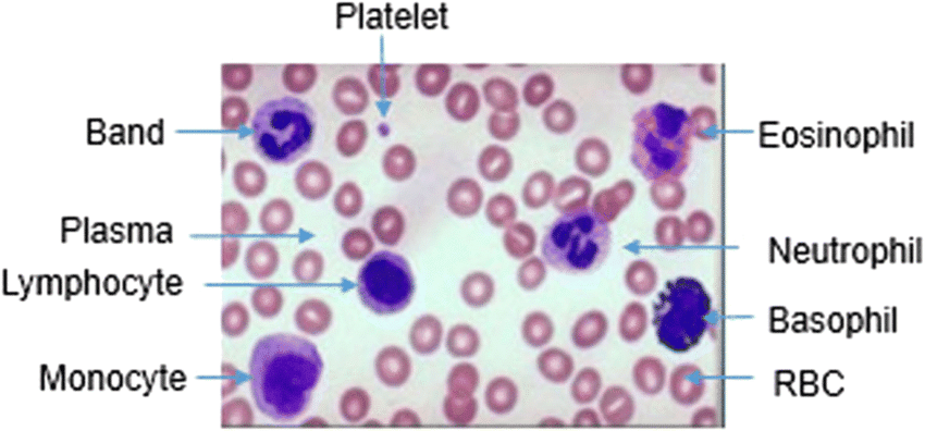 Preparation And Staining Of Peripheral Blood Smear(PS)|A Step-by-Step Guide: Peripheral Blood ...