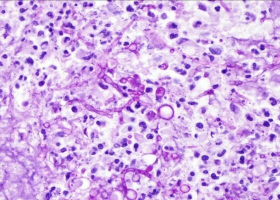 PAS Stain : Principle, Procedure, Uses