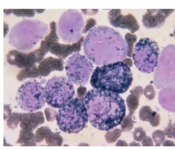Myeloperoxidase Stain(MPO)-principle ,procedure ,uses