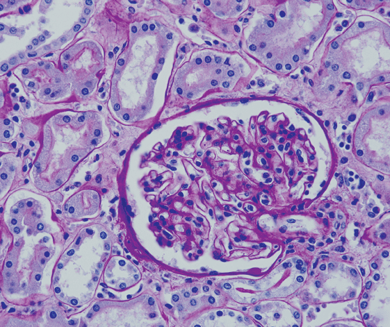 PAS Stain : Principle, Procedure, Uses