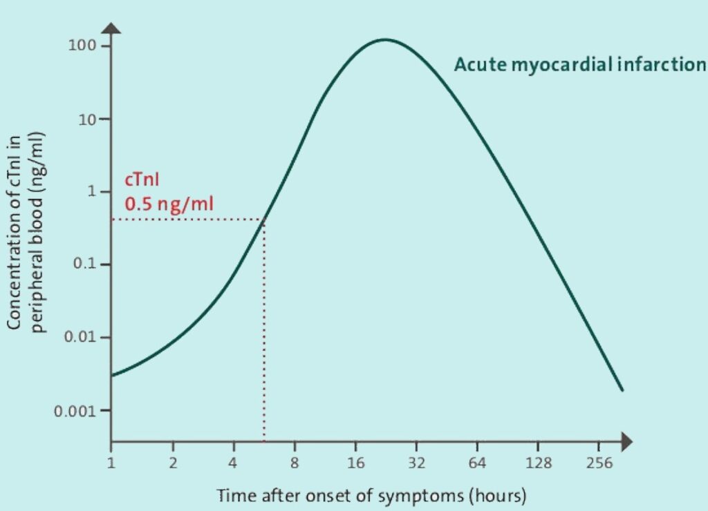 Cardiac Troponins -Troponin I ,Troponin T TEST - Clinical Laboratory Guide